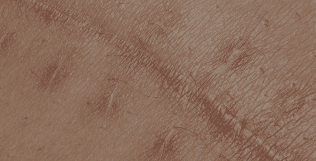 The Many Scars of Men - MDI - Mentoring men to live with excellence ...