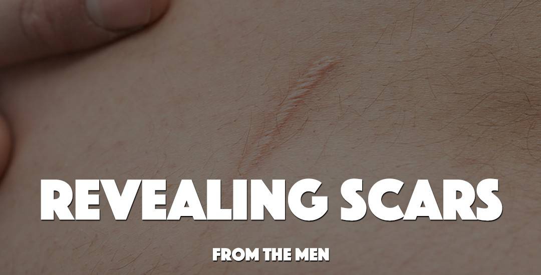 Revealing Scars - From the Men - MDI - Mentoring men to live with ...