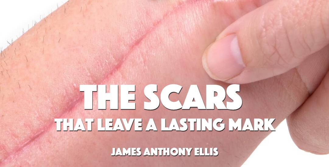 The Scars That Leave a Lasting Mark - MDI - Mentoring men to live with ...